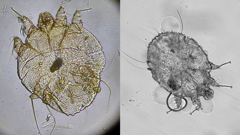 Nijmeegse microbioloog pleit voor een gecoördineerde aanpak van schurft ...