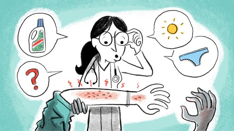 Schurft wordt vaak niet meteen herkend door huisarts: 'Ik heb nachten ...