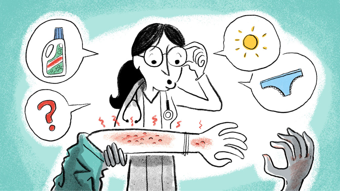 Schurft wordt vaak niet meteen herkend door huisarts: 'Ik heb nachten ...